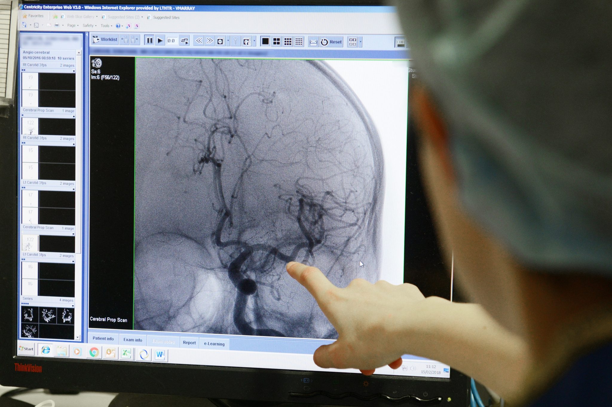 Neurophysiology - The Health Academy